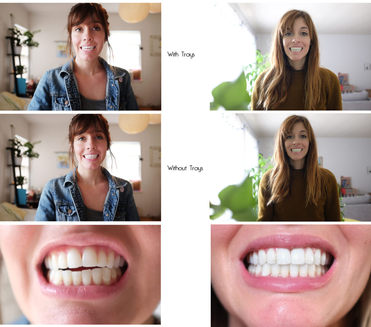 Invisalign Las Vegas Dental Group | Certified Invisalign Providers