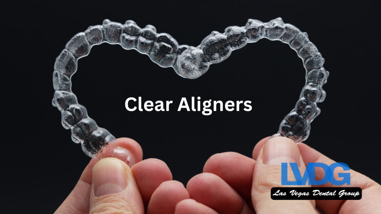 Clear Aligners Las Vegas Dental Group | Aligners Dentist